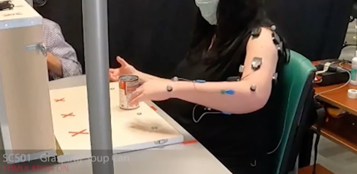 Spinal Cord Stimulation Instantly Improves Arm Mobility After Stroke ...