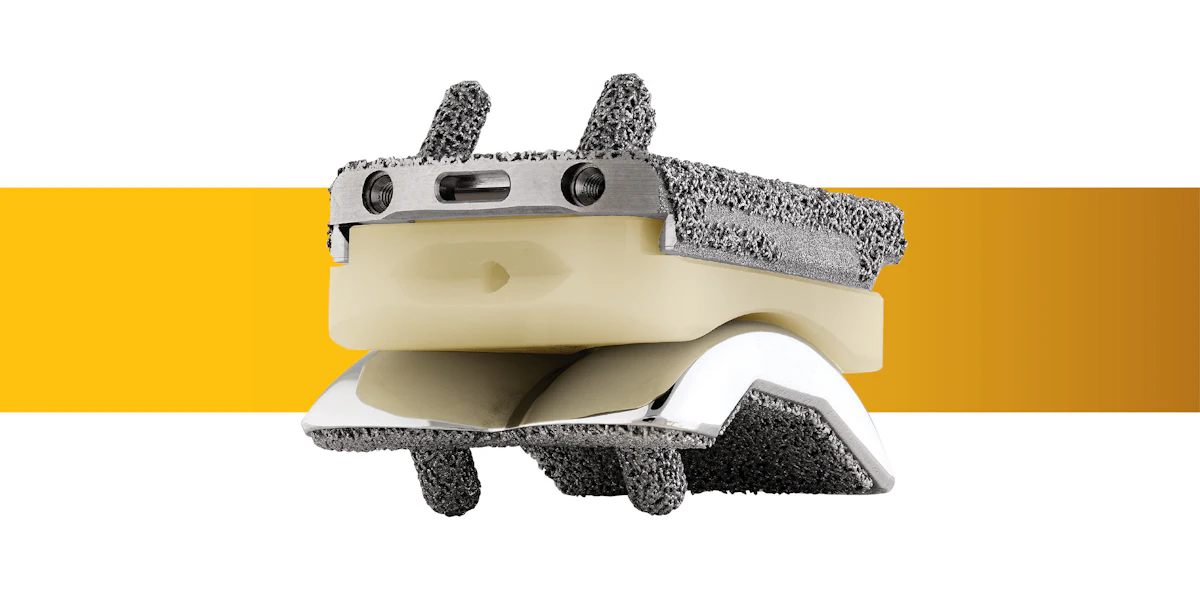 Stryker’s Total Ankle System Used in First Surgeries in Europe ...