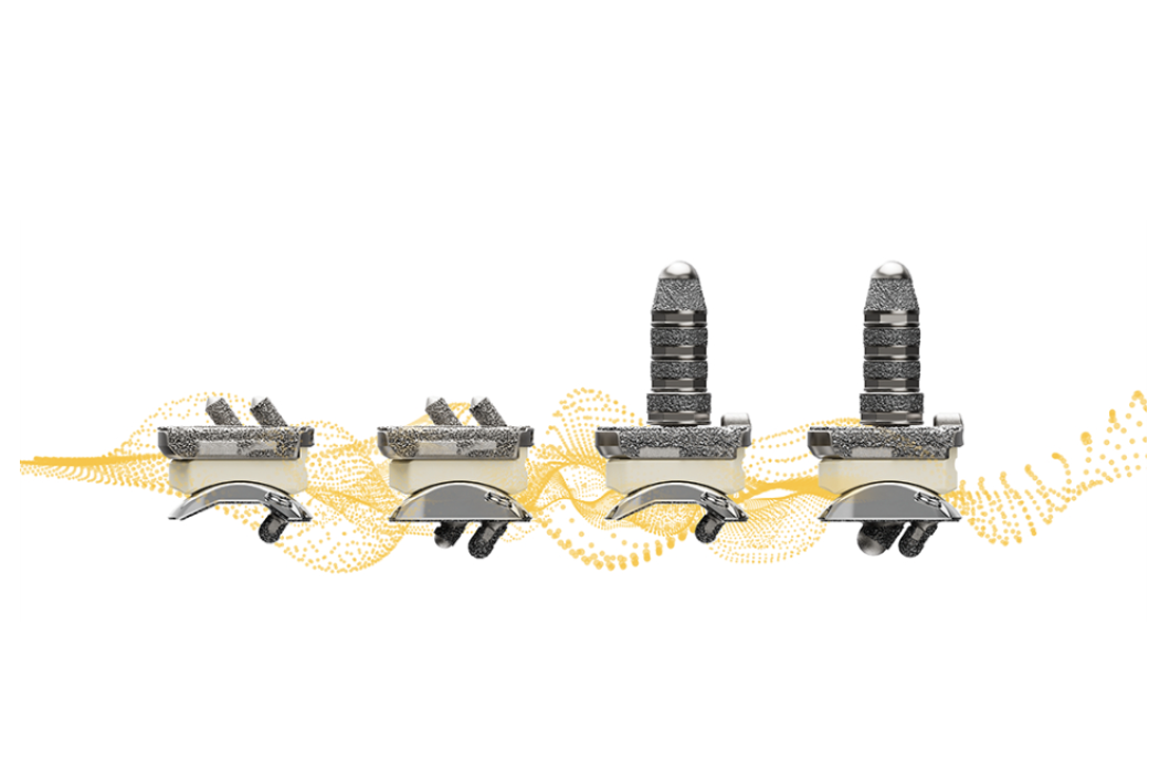 Stryker Launches Incompass Total Ankle System | Medical Design ...