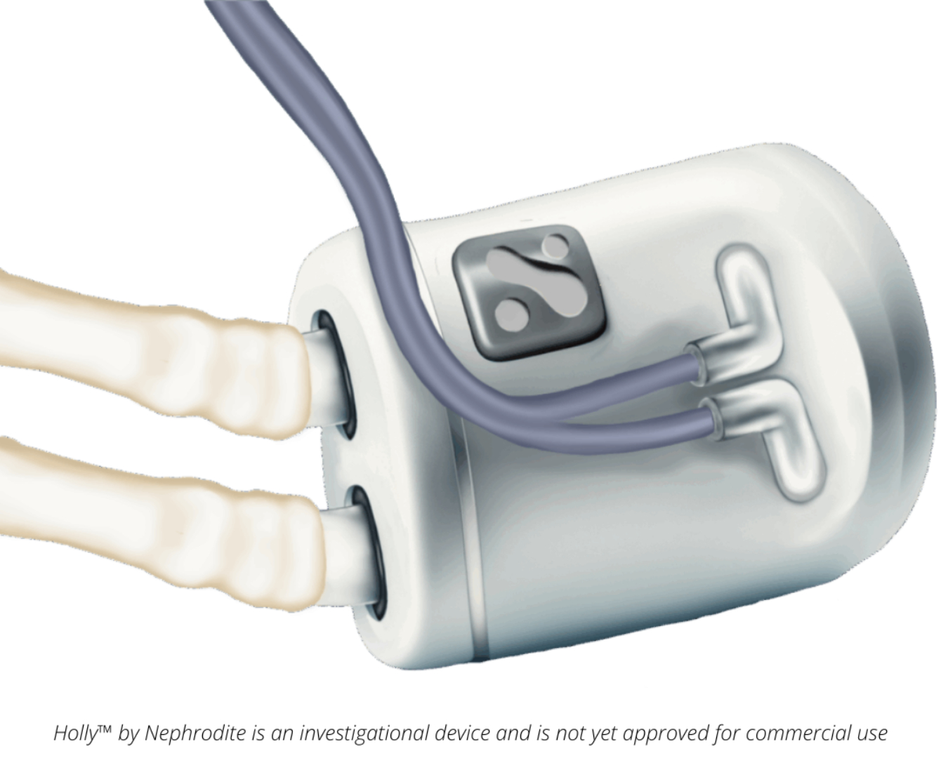 Artificial Replacement Kidney Inches Closer to FDA Approval | Medical ...