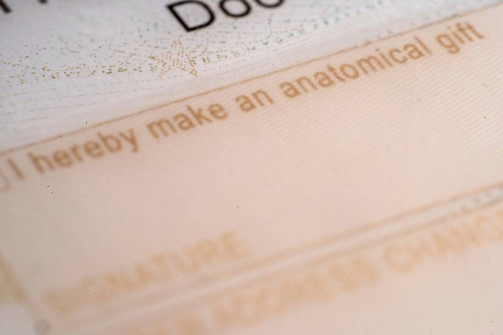 Public Mistrust Linked to Drop in Deceased Donor Organ Donations ...