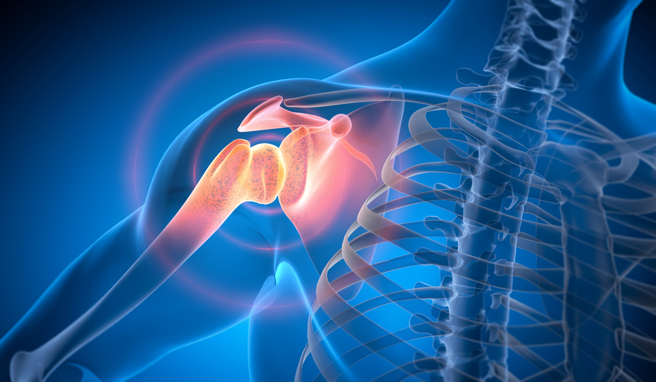 Smith+Nephew Buys Shoulder Repair Specialist Integrity Orthopaedics for ...