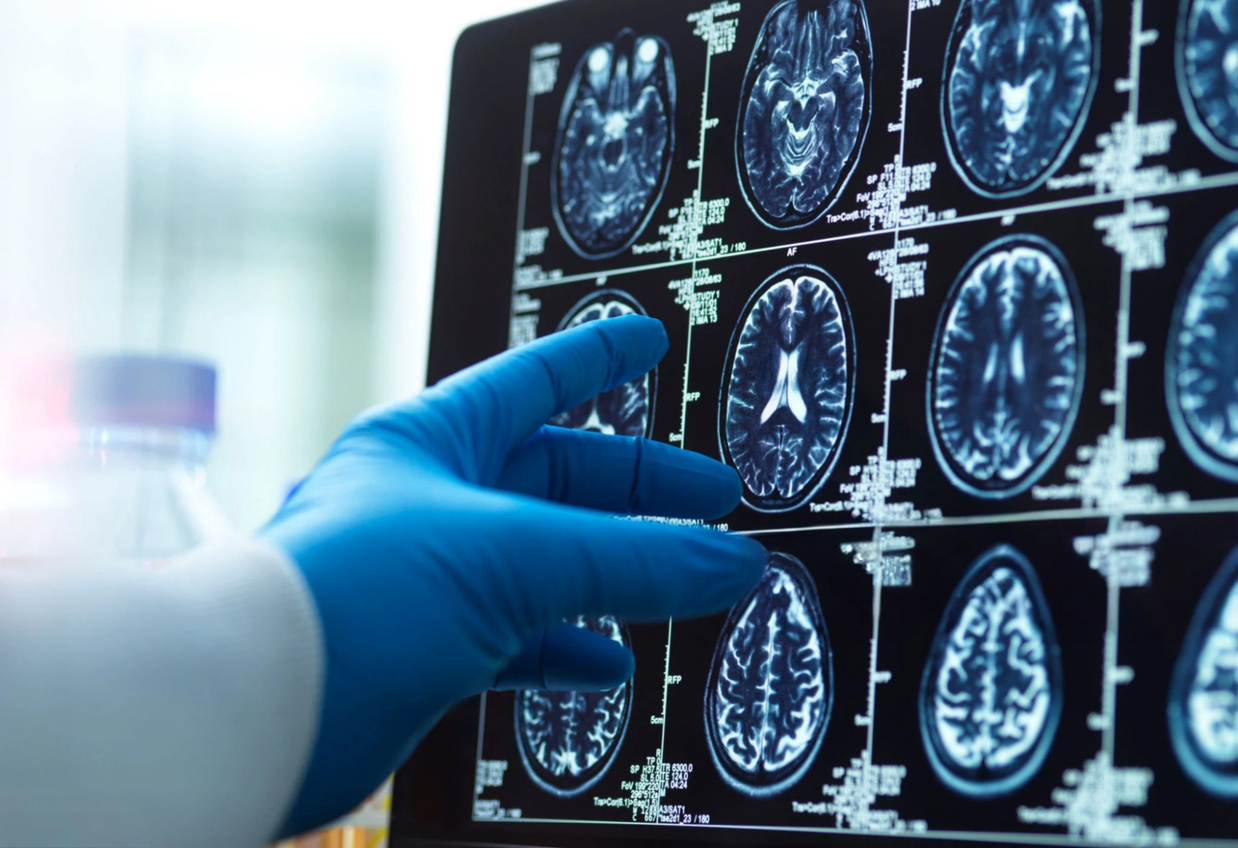 New 3D Imaging System Could Address Limitations of MRI, CT and ...