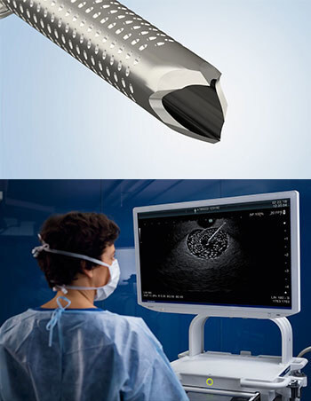 Olympus Launches Single-Use Fine Needle Biopsy Device in the U.S ...