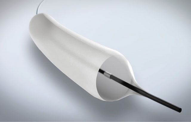 FDA Approves Drug Coated Balloon to Treat Central Airway Stenosis ...